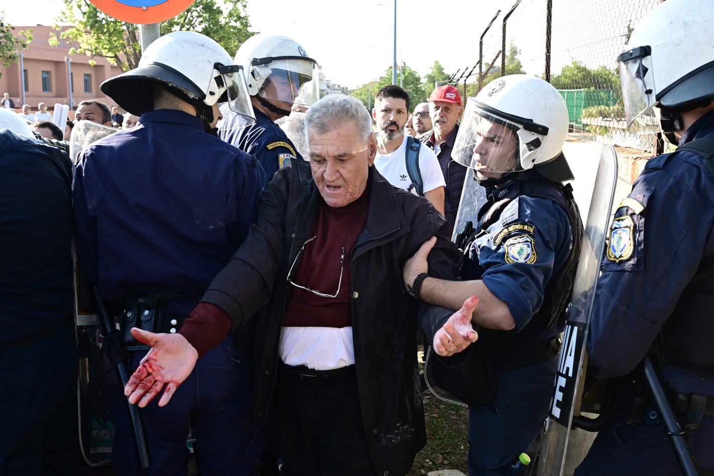Αγρίεψαν τα πράγματα: Συμπλοκές και αίμα στην επίσκεψη Κ.Μητσοτάκη και ...